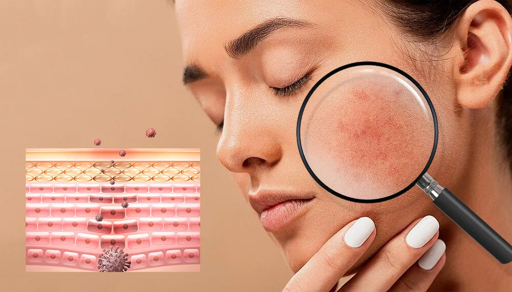 How to Unclog Pores: A Comprehensive Guide for 2025